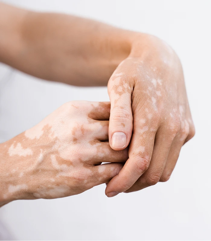 Skin Conditions in Detroit & Dearborn, MI | Dermatology Institute of ...